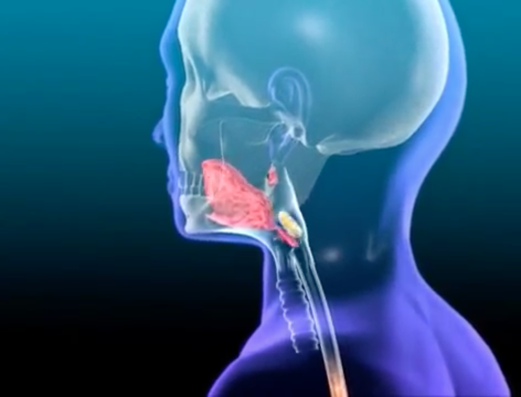 How to Mew Evenly: Fixing Asymmetry Caused by Imbalanced Tongue ...